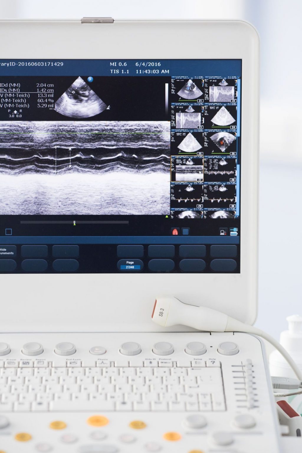 Cardiac And Vascular Diagnostics – Integrated Clinical Cardiovascular ...